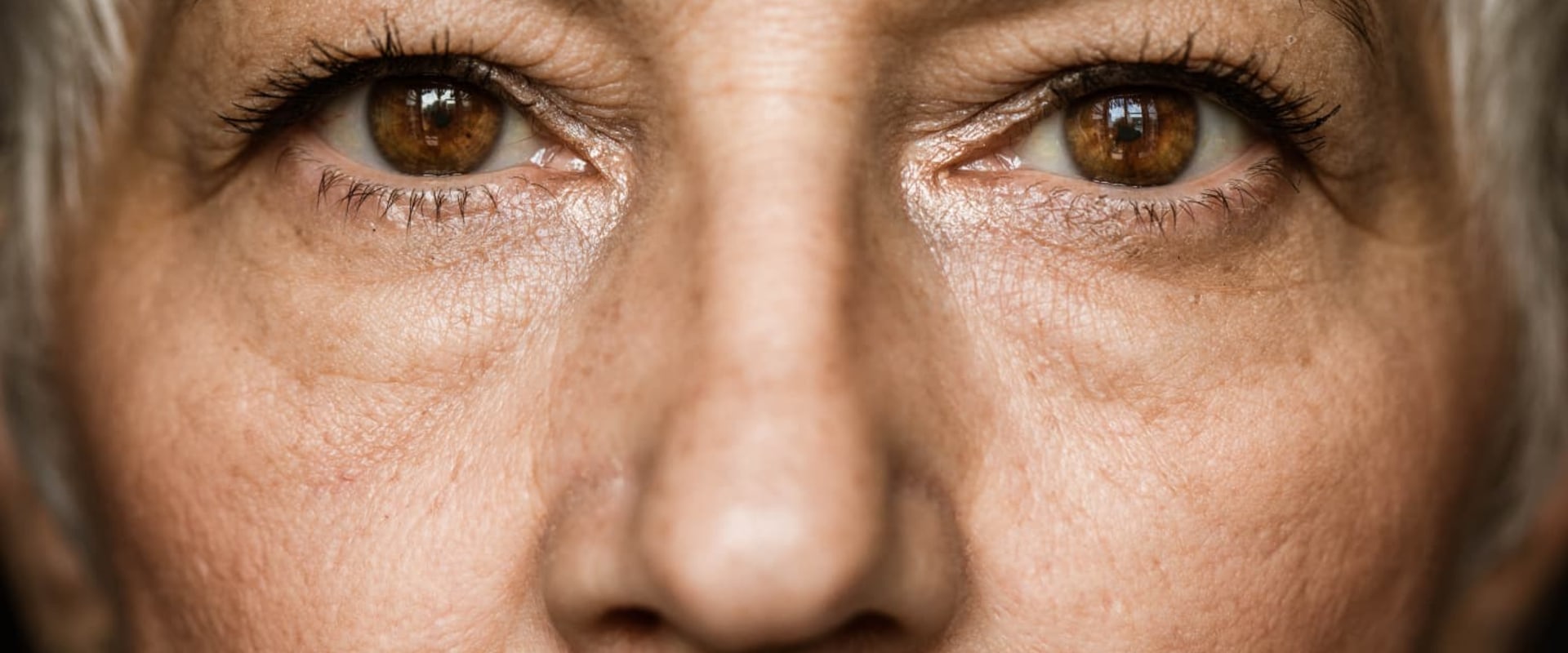 When Is The Right Time To Call The Doctor After Cataract Surgery when-is-the-right-time-to-call-the-doctor-after-cataract-surgery
